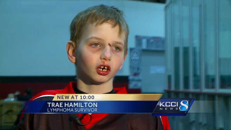 Hockey father, son duo skates to beat out cancer