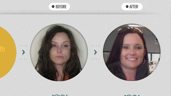 Before and after: Photos of drug addiction recovery