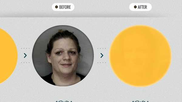 Before and after: Photos of drug addiction recovery
