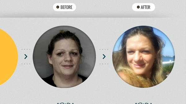 Before and after: Photos of drug addiction recovery