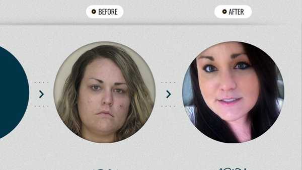 Before and after: Photos of drug addiction recovery