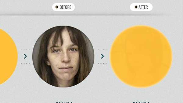Before and after: Photos of drug addiction recovery