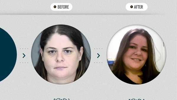 Before and after: Photos of drug addiction recovery