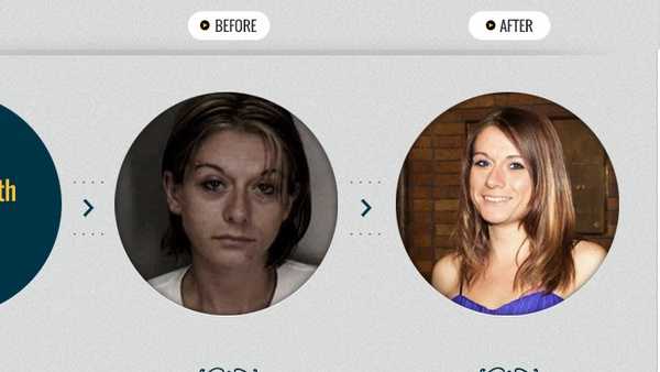 Before and after: Photos of drug addiction recovery