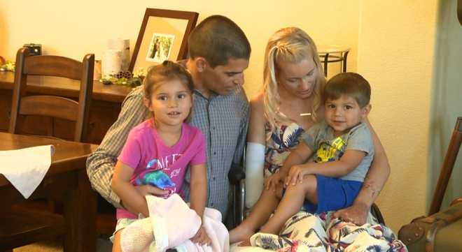 Mom stays positive after illness leads to amputations