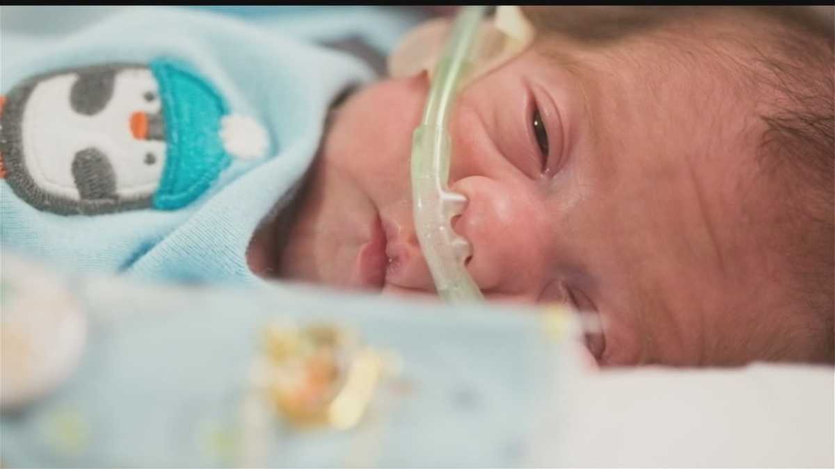Baby born weeks after mother suffers brain bleed