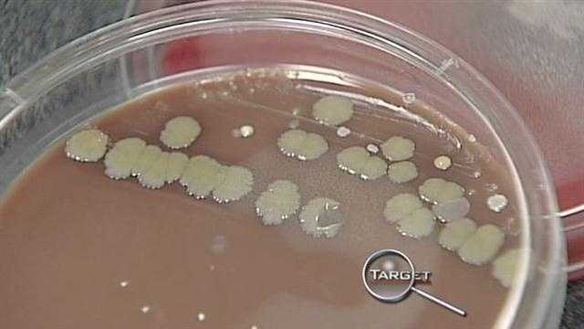 Photos: Gas pumps teeming with germs