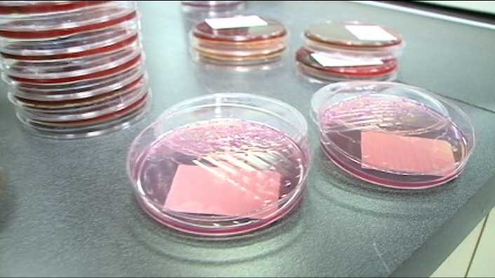 Barbecues provide prime breeding ground for germs