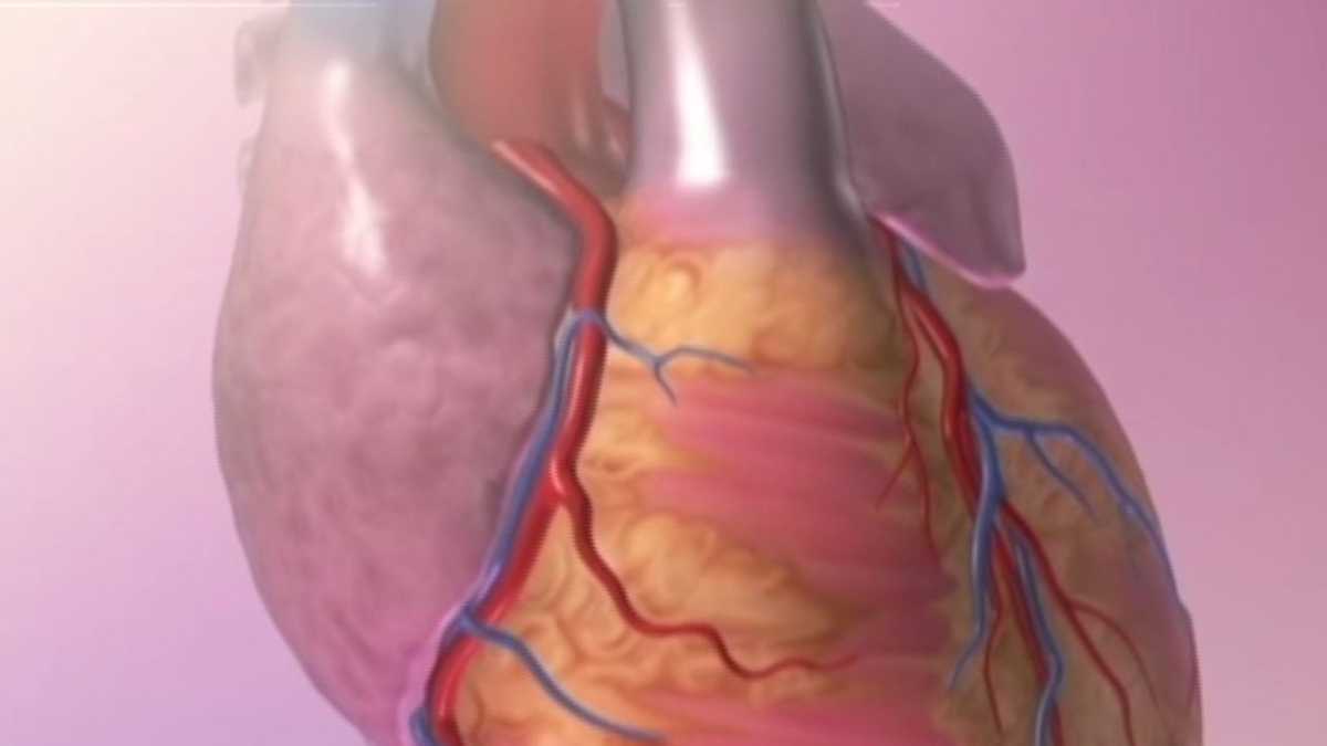 7 Things That Help Prevent Heart Attacks