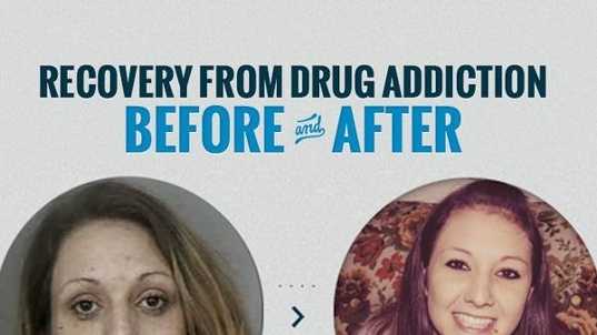 Before and after: Recovery from drug addiction