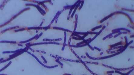 Watch out for anthrax in livestock this summer