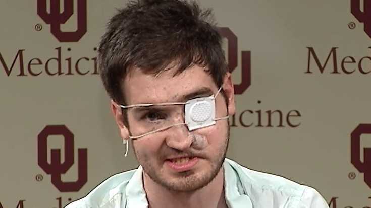 Tulsa man disfigured by fireworks warns of dangers