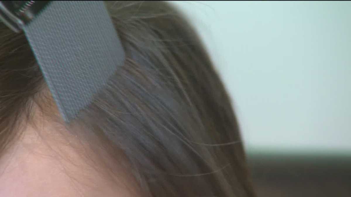 Expert: Parents need education about head lice
