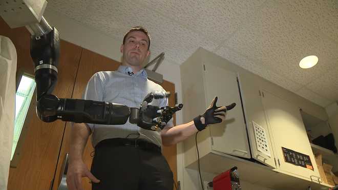 Hopkins develops mind-controlled prosthetic arm