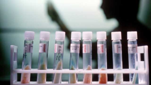 Study: Flaws in genetic testing cause unneeded worry