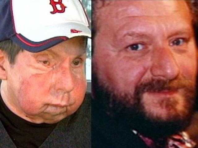 Medical miracles: following the patients of Boston Med