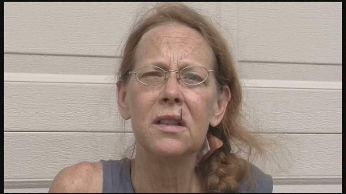 Woman attacked by dogs: 'It was a frenzy'