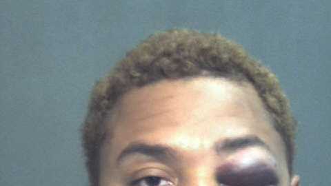 Man stabbed in eye during fight near UCF, deputies say