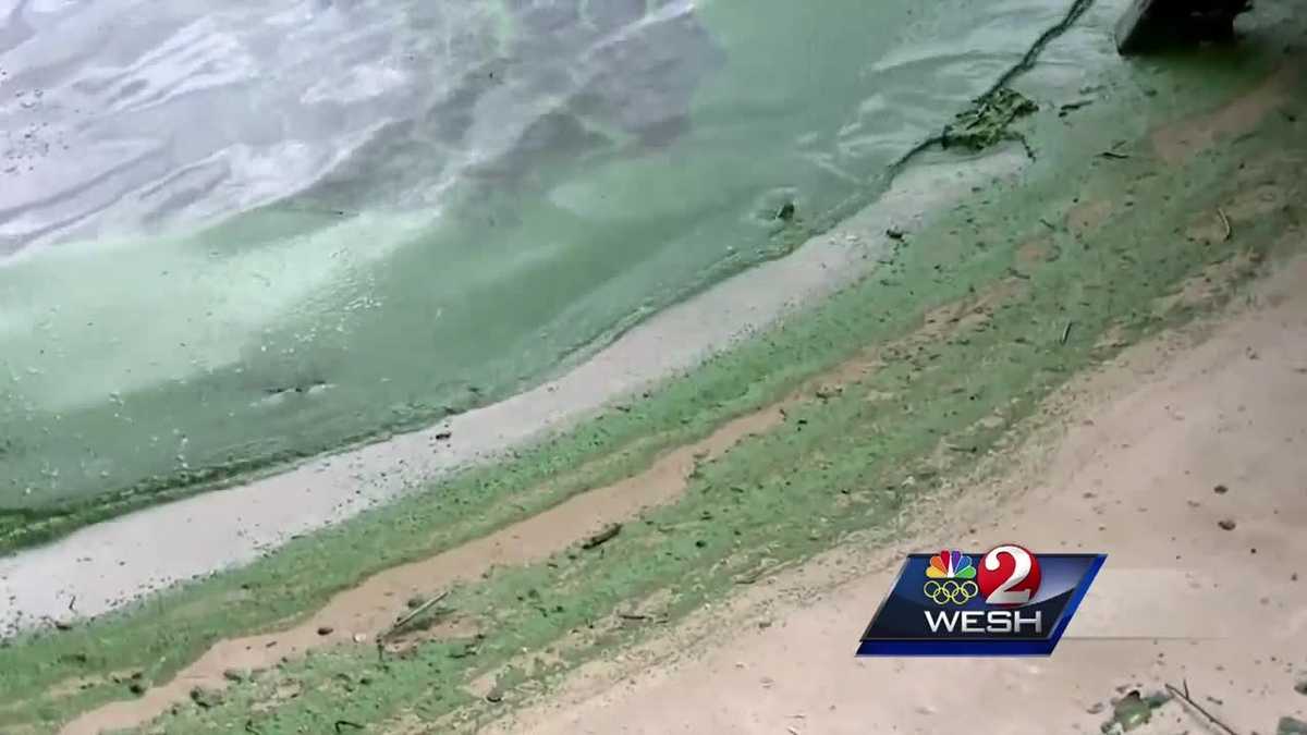 Florida’s toxic algae may cause debilitating diseases, professor says
