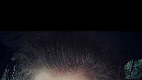 Before and After: Jennifer Butters