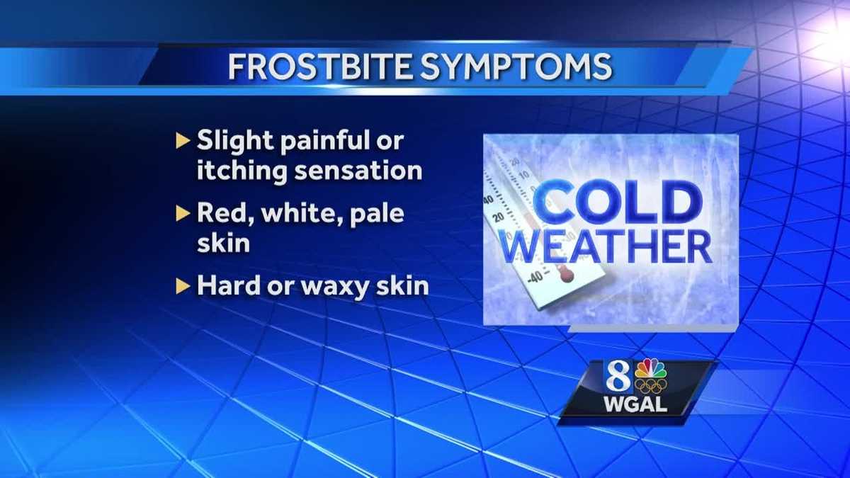 How to prevent frostbite, hypothermia