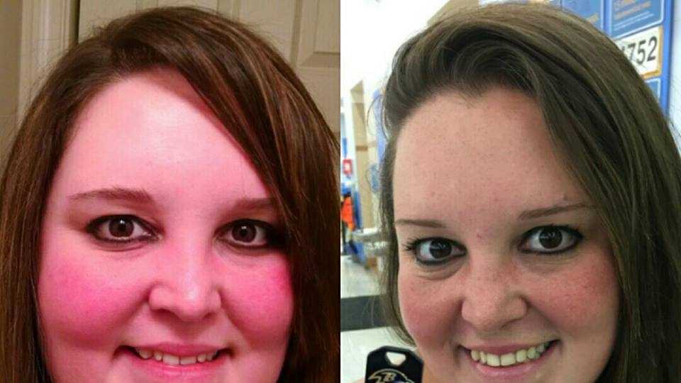 Before and After: Local couple loses 177 pounds - together!