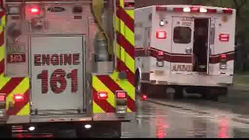 Molten metal burn one of most severe