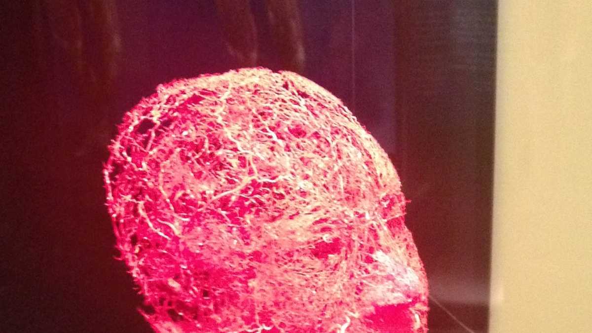 Images: Body Worlds Exhibit Opens at Kentucky Science Center