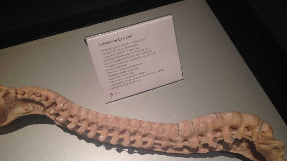 Images: Body Worlds Exhibit Opens at Kentucky Science Center