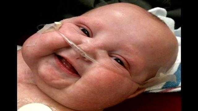 Toddler born with half a heart fights for life