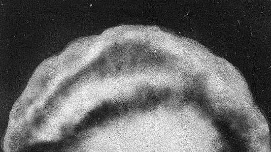 Photos: The Boston Strangler case
