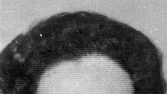 Photos: The Boston Strangler case