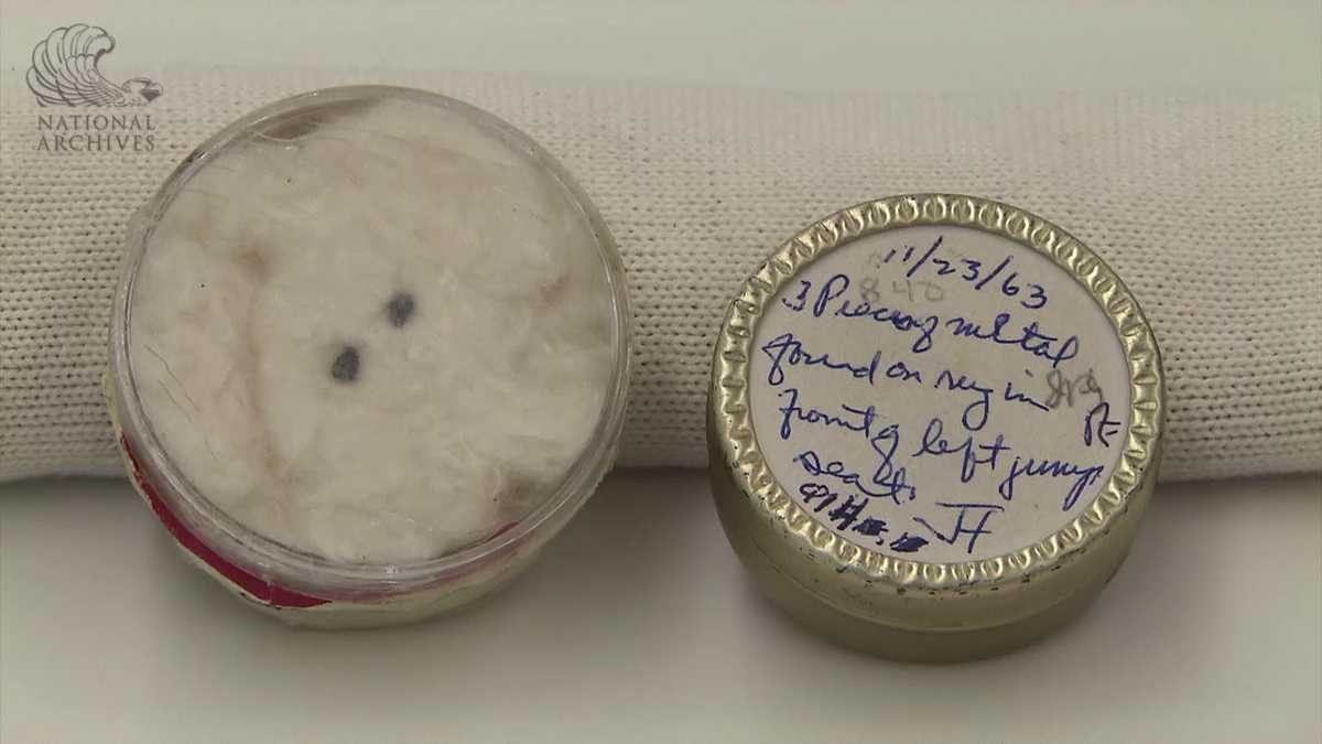 Photos: Evidence from the JFK assassination