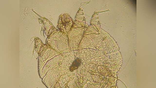 Preventative scabies treatment clinics open in NH