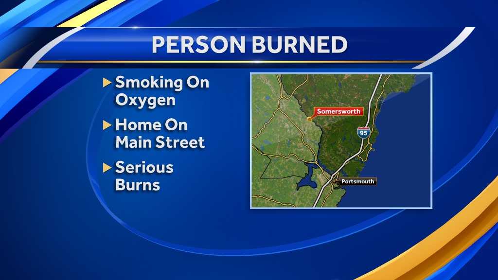 Officials: Person smoking while on oxygen suffers serious burns