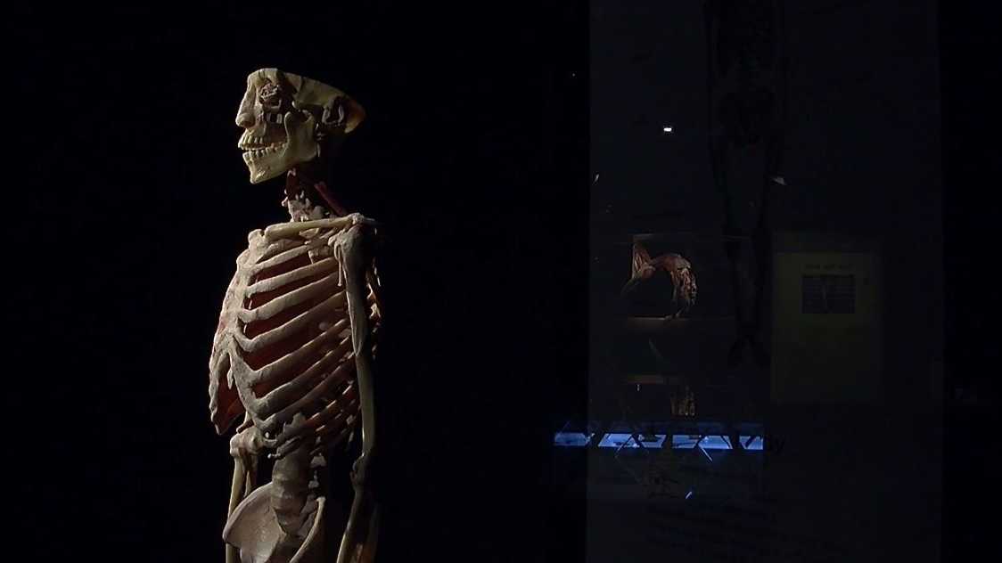 Photos: Exhibit uses real bodies to show human anatomy