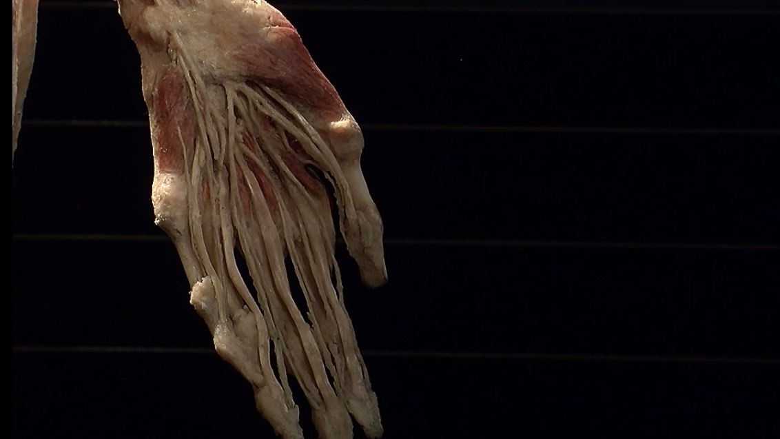 Photos: Exhibit uses real bodies to show human anatomy