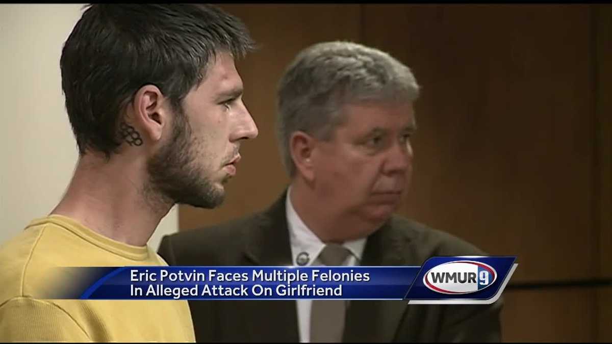 Man Accused Of Burning Cutting Girlfriend