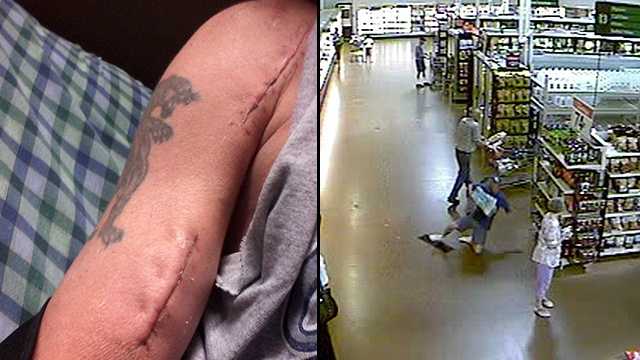 Man who suffers from 'popeye deformity' after Walmart fall awarded $1.3M