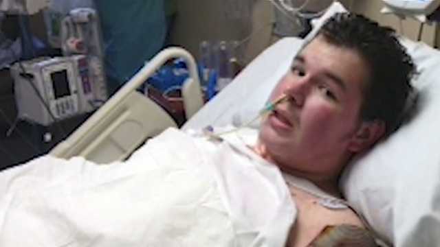 Man, 20, recovers after campfire accident