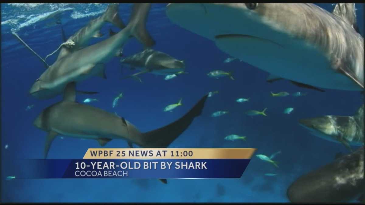 Boy bitten by shark, rescuers say it's worst bite they've seen in years