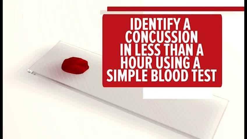 Company claims blood test can detect concussion quickly