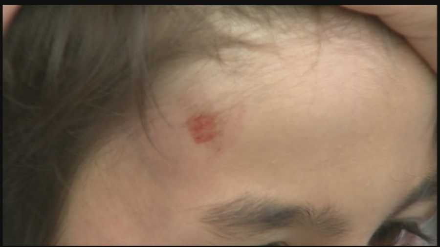 Photos: Boy meets baseball stars after getting beaned