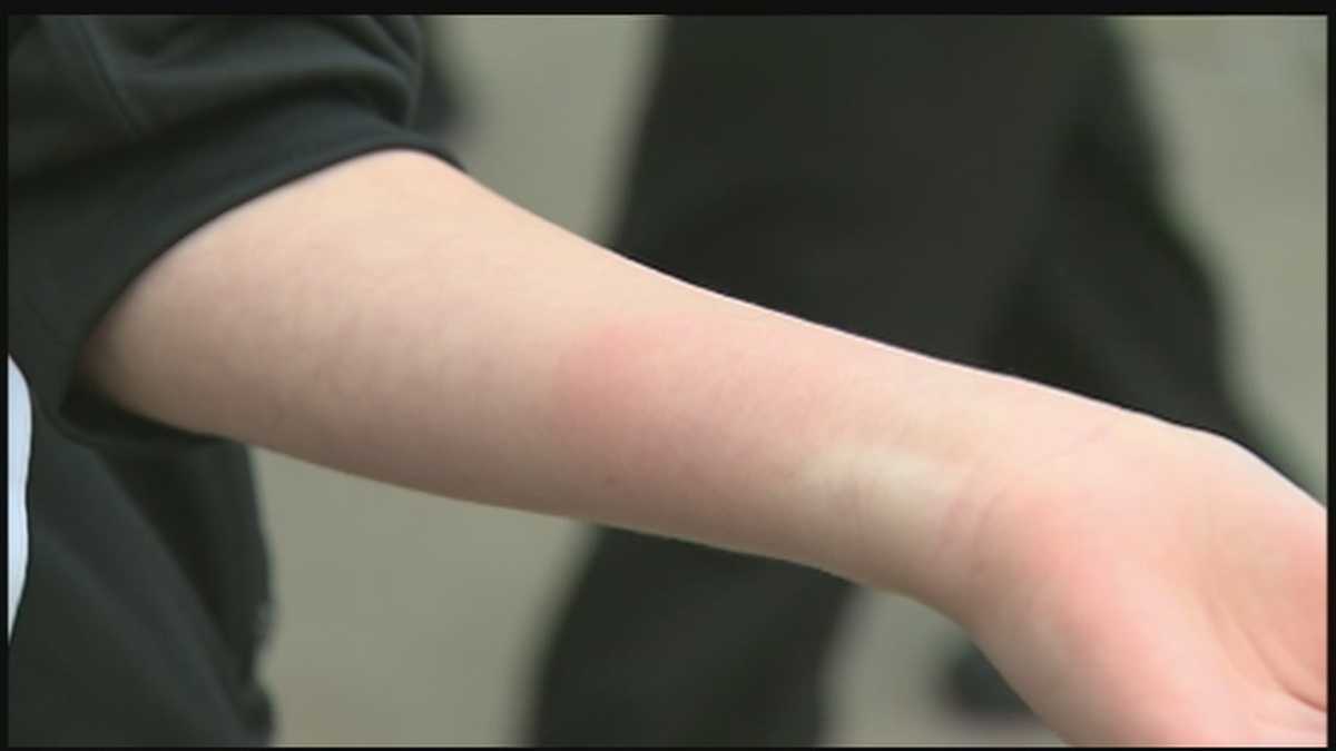 Photos: Boy meets baseball stars after getting beaned