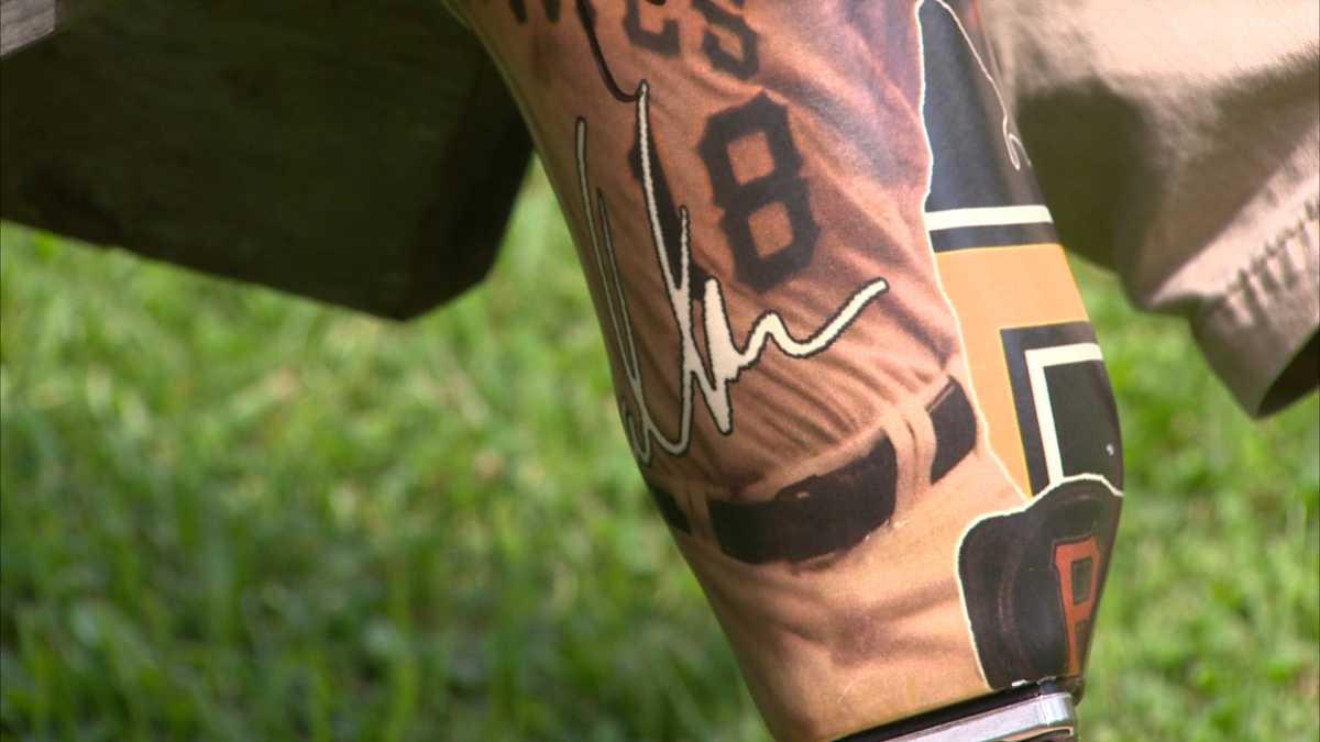 Photos: Boy's prosthetic leg shows Pirates pride