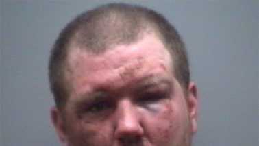 Deputies: Officer assaulted, dog fatally shot during same call