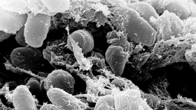 15 of history’s deadliest disease outbreaks 15 of history’s deadliest disease outbreaks