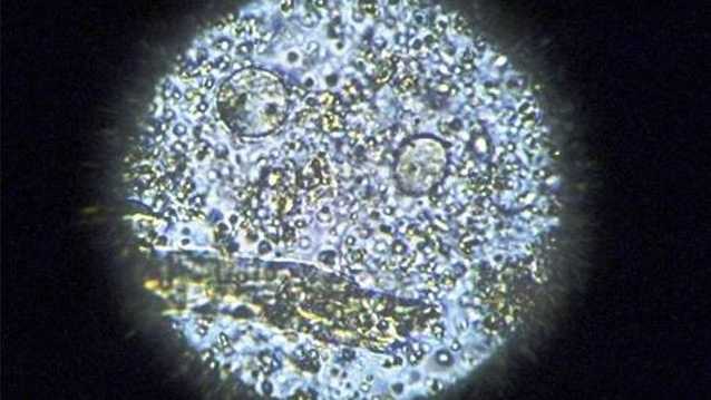 E.coli information from the Mayo Clinc