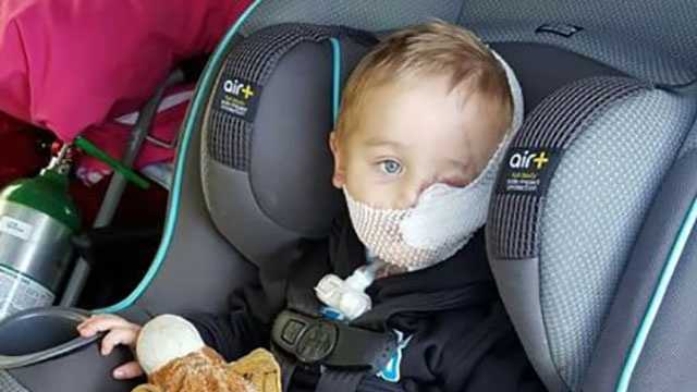 Toddler severely mauled by dogs gets released from hospital