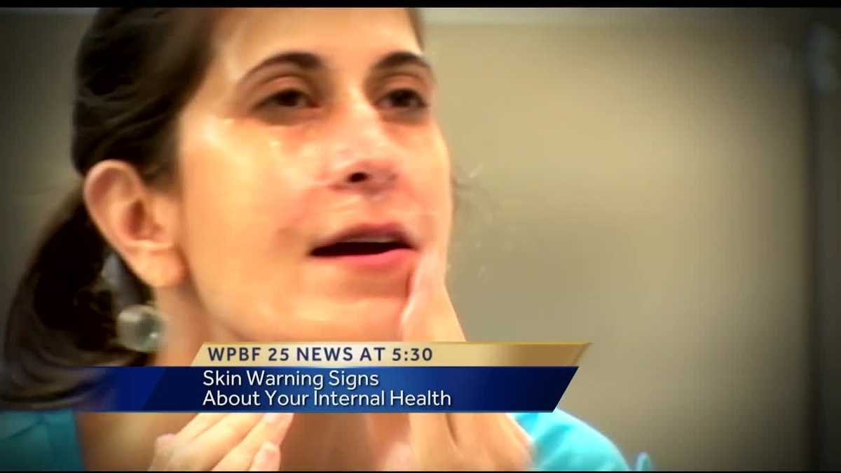 Skin warning signs about your internal health